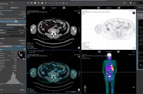 Advanced Medical Systems
