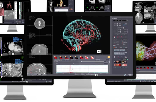 Advanced Medical Systems