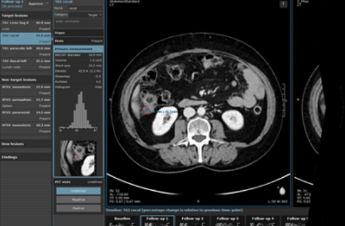 Advanced Medical Systems